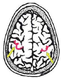 Esquema del área motora de la mano Se observa en el surco precentral ...